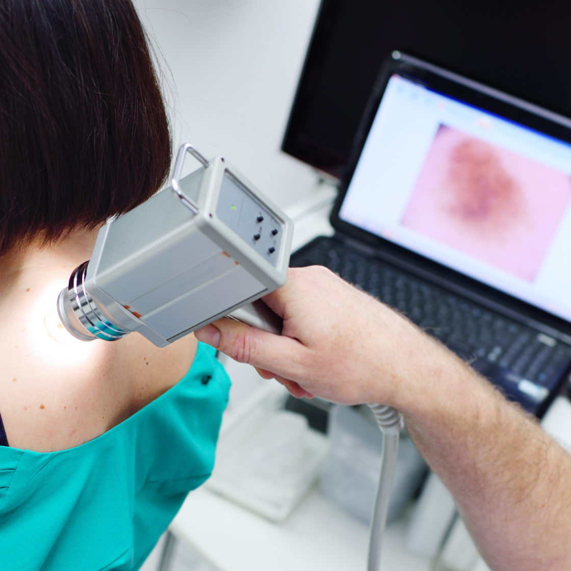 Dermatologie et épilation laser - Centre Médical de l'Alliance Braine l ...